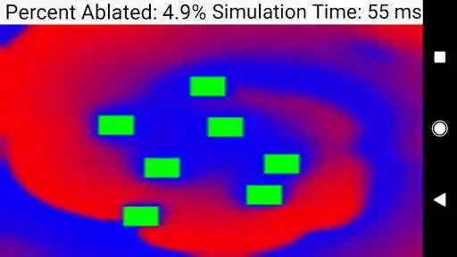 Biophysical Cardiac Ablation Simulator online game with UptoPlay