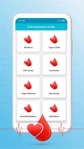 ECG Interpretation guide 2023 online game with UptoPlay